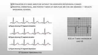 Myocardial infarction: introduction, clinical manifestation ...