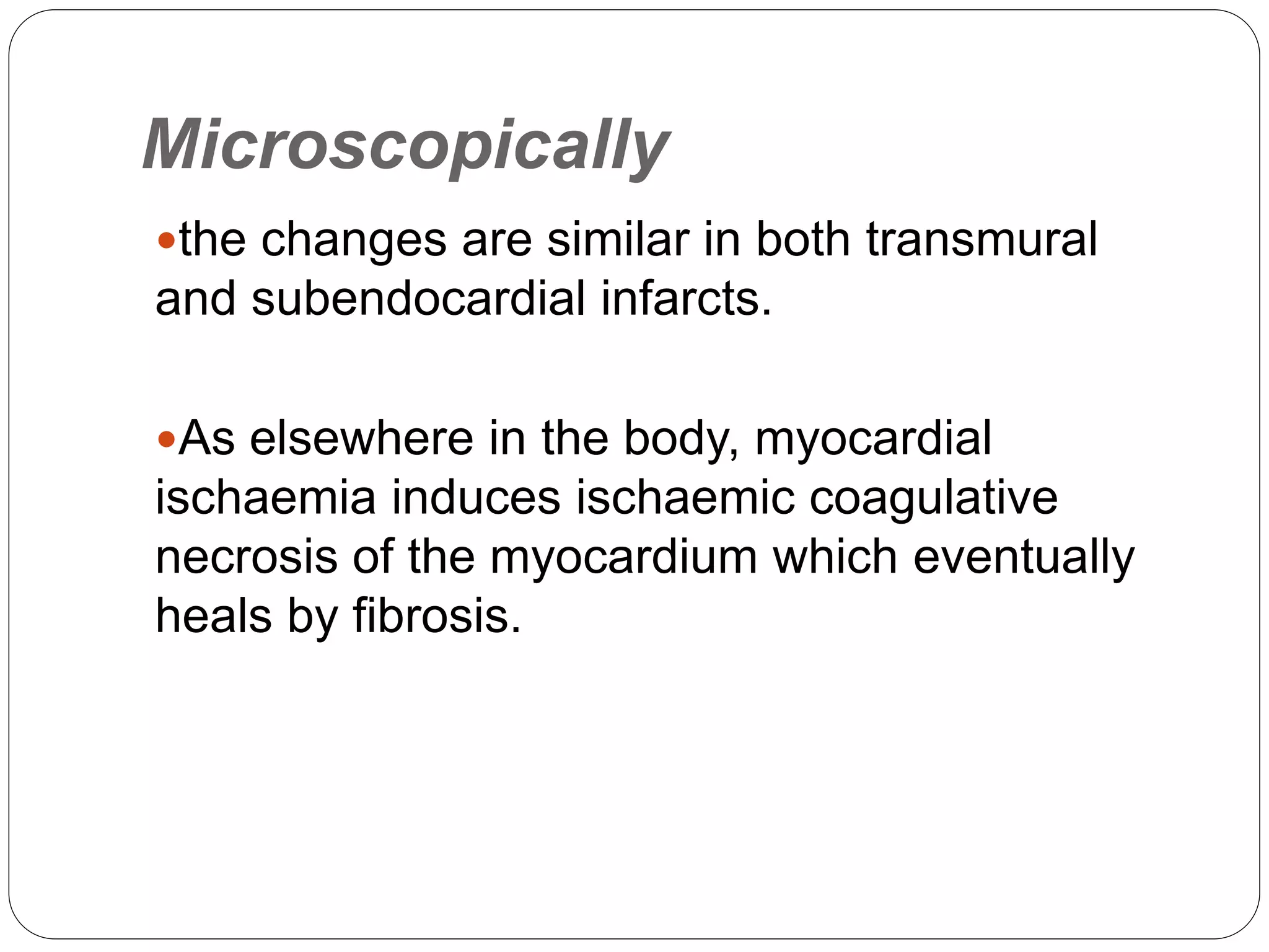 Myocardial infarction | PPTX