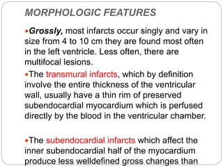 Myocardial infarction | PPTX
