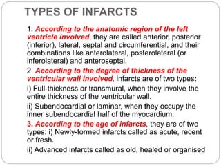 Myocardial infarction | PPTX
