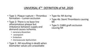 Myocardial infarction | PPTX