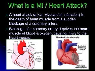 Myocardial Infarction.ppt