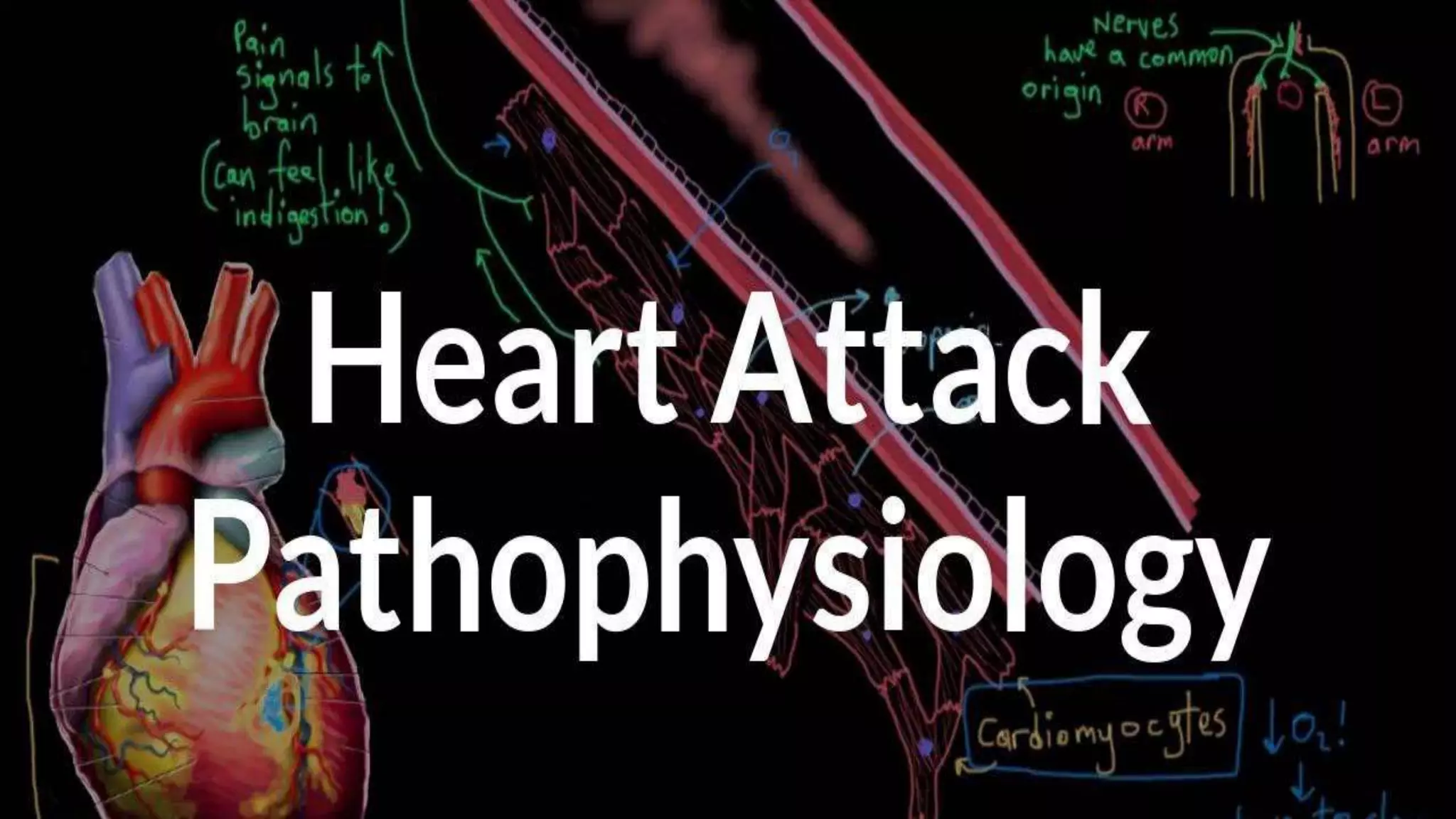 MYOCARDIAL INFARCTION.pptx