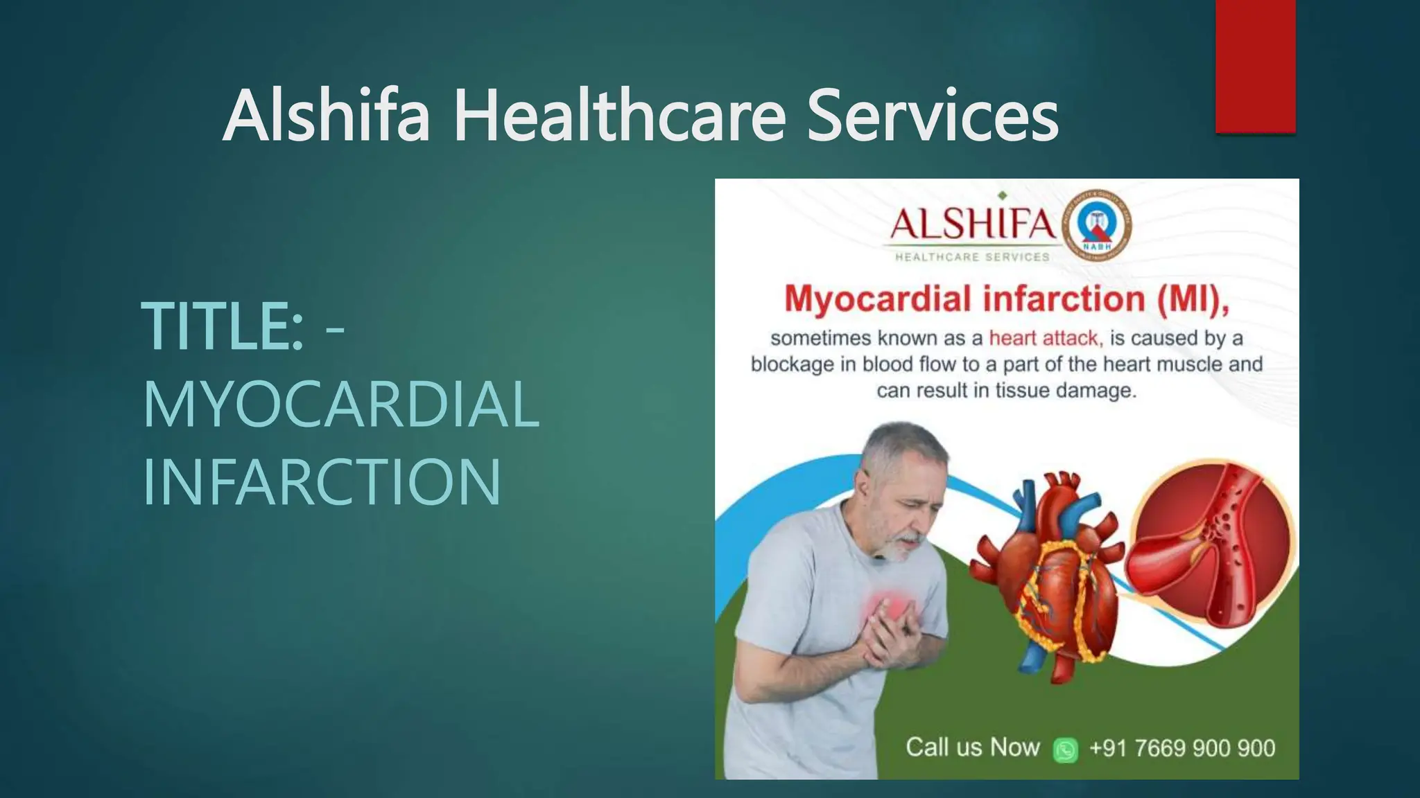 Understanding Myocardial Infarction: Pathophysiology, Diagnosis, and ...