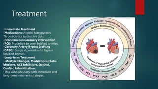 Understanding Myocardial Infarction: Pathophysiology, Diagnosis, and ...