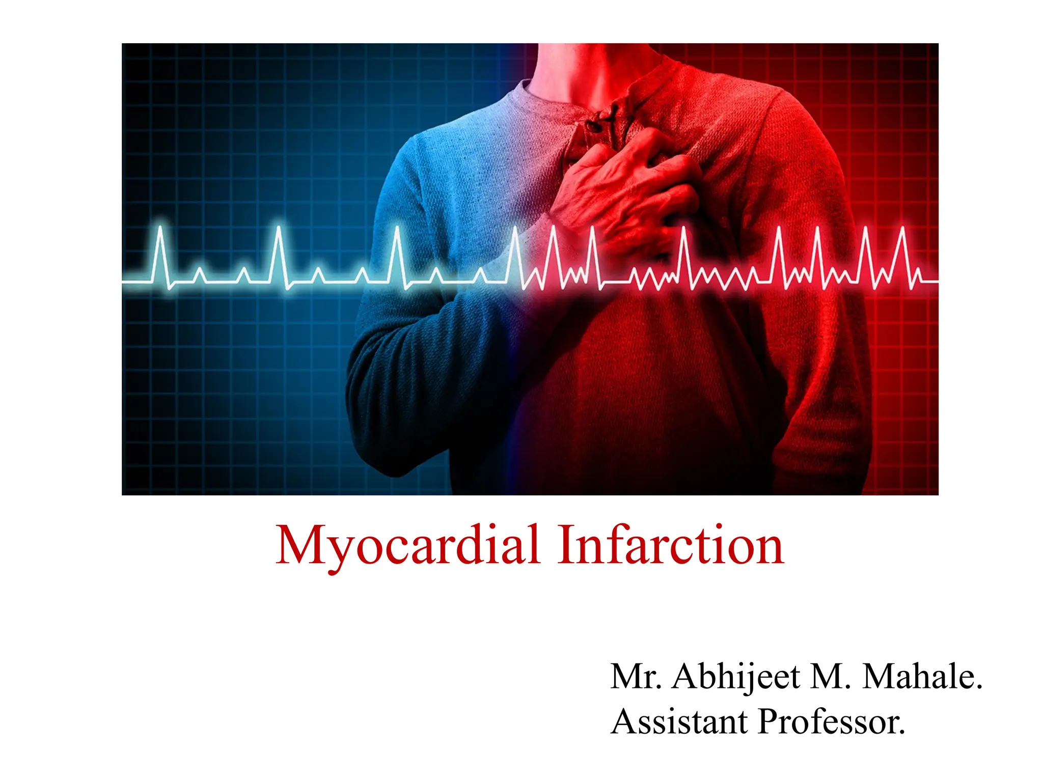 Myocardial Infarction ( MI ) Heart Attack.pptx