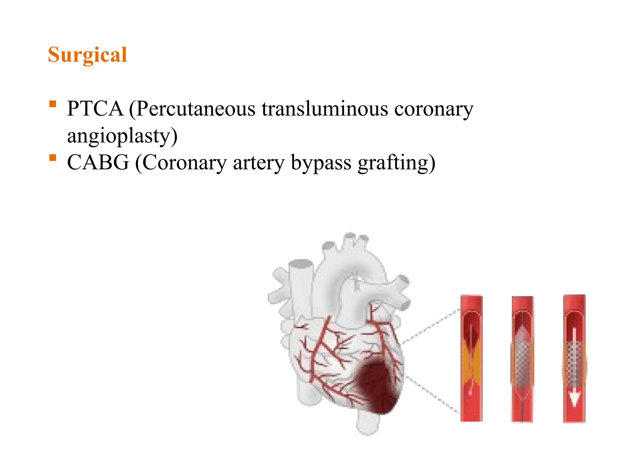 Myocardial Infarction ( MI ) Heart Attack.pptx