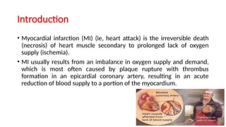 Myocardial Infarction. Pharmacotherapeutics pptx | PPT