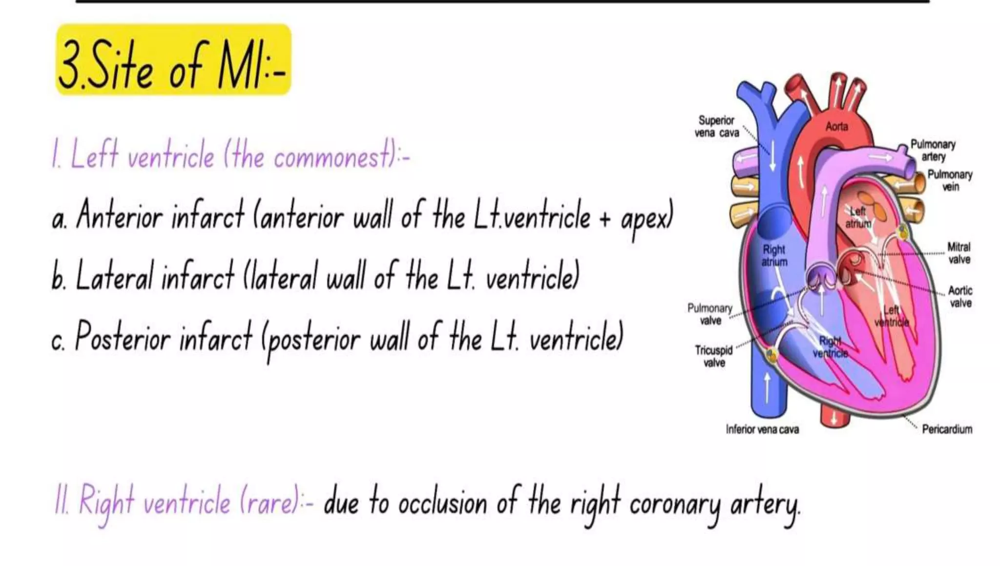 MYOCARDIAL INFARCTION SLIDESHARE | PPTX