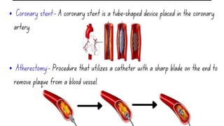 MYOCARDIAL INFARCTION SLIDESHARE | PPTX