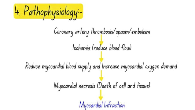 MYOCARDIAL INFARCTION SLIDESHARE | PPTX