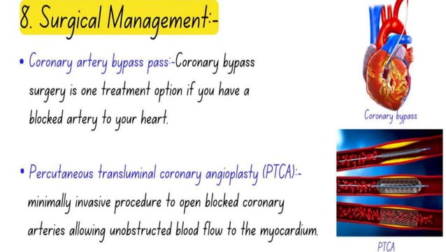 MYOCARDIAL INFARCTION SLIDESHARE | PPTX