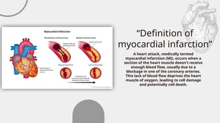 Myocardial Infarction for fist grade medical students made by iraqi ...