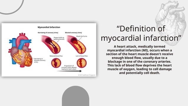 Myocardial Infarction for fist grade medical students made by iraqi ...