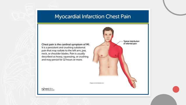 Myocardial Infarction for fist grade medical students made by iraqi ...