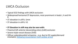 Myocardial infarction [autosaved] | PPTX