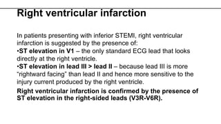 Myocardial infarction [autosaved] | PPTX