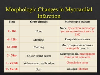 MYOCARDIAL INFARCTION THEORY .pptx