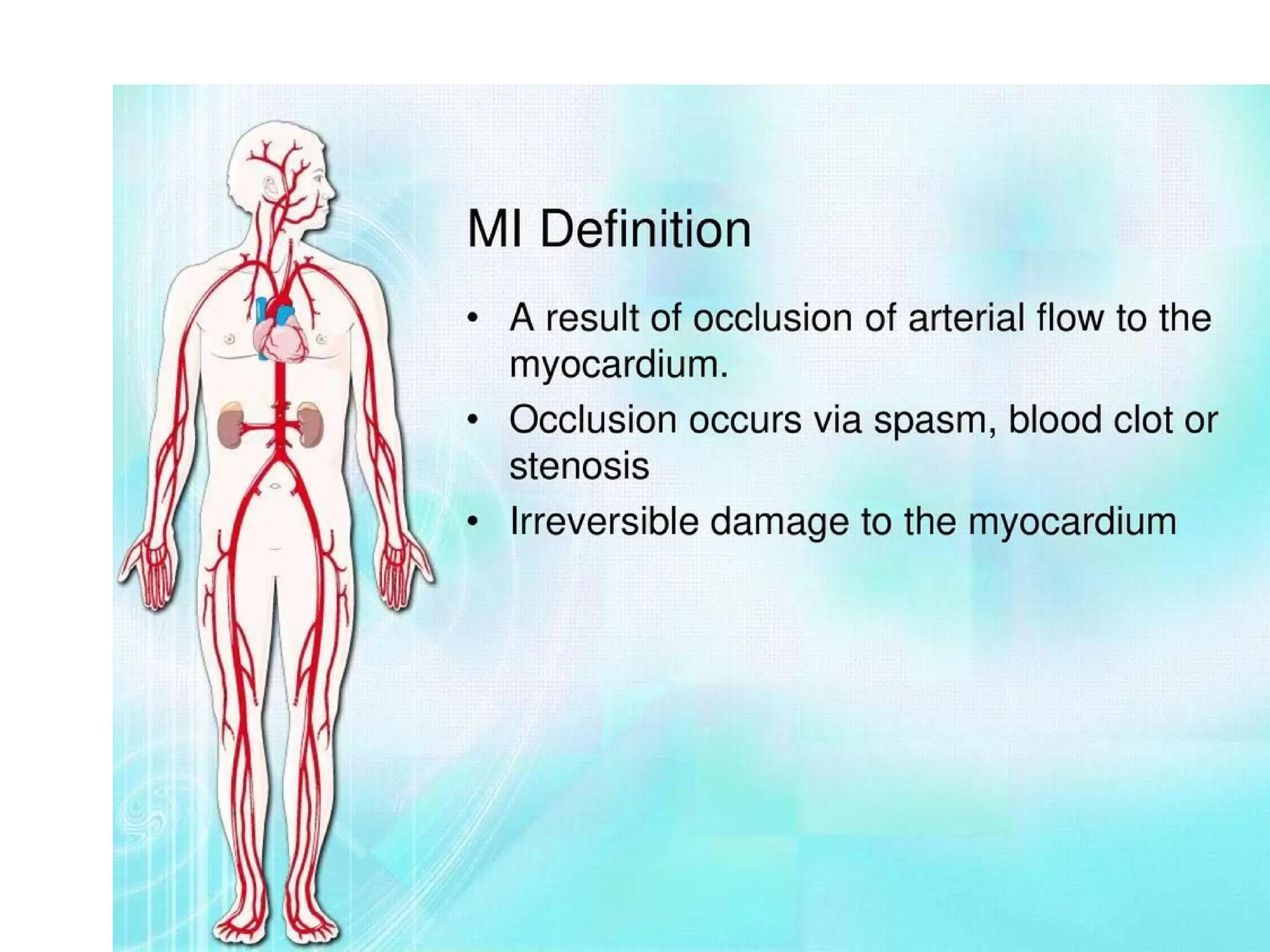 Presentation Myocardial_infarction FINAL.ppt