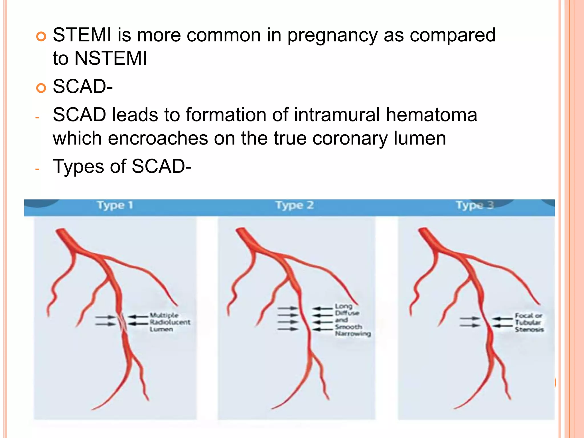 Myocardial infarction in young.pptx