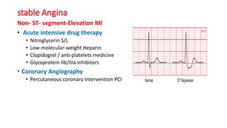 Myocardial Infarction MI [Autosaved].pptx