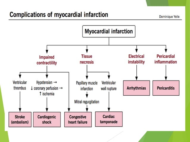Myocardial Infarction | PPT | Free Download