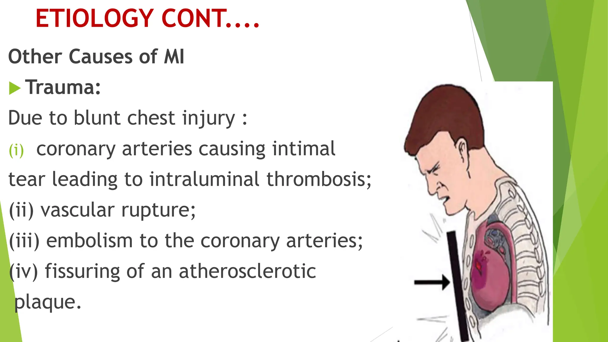 MYOCARDIAL INFARCTION nursing management | PPTX