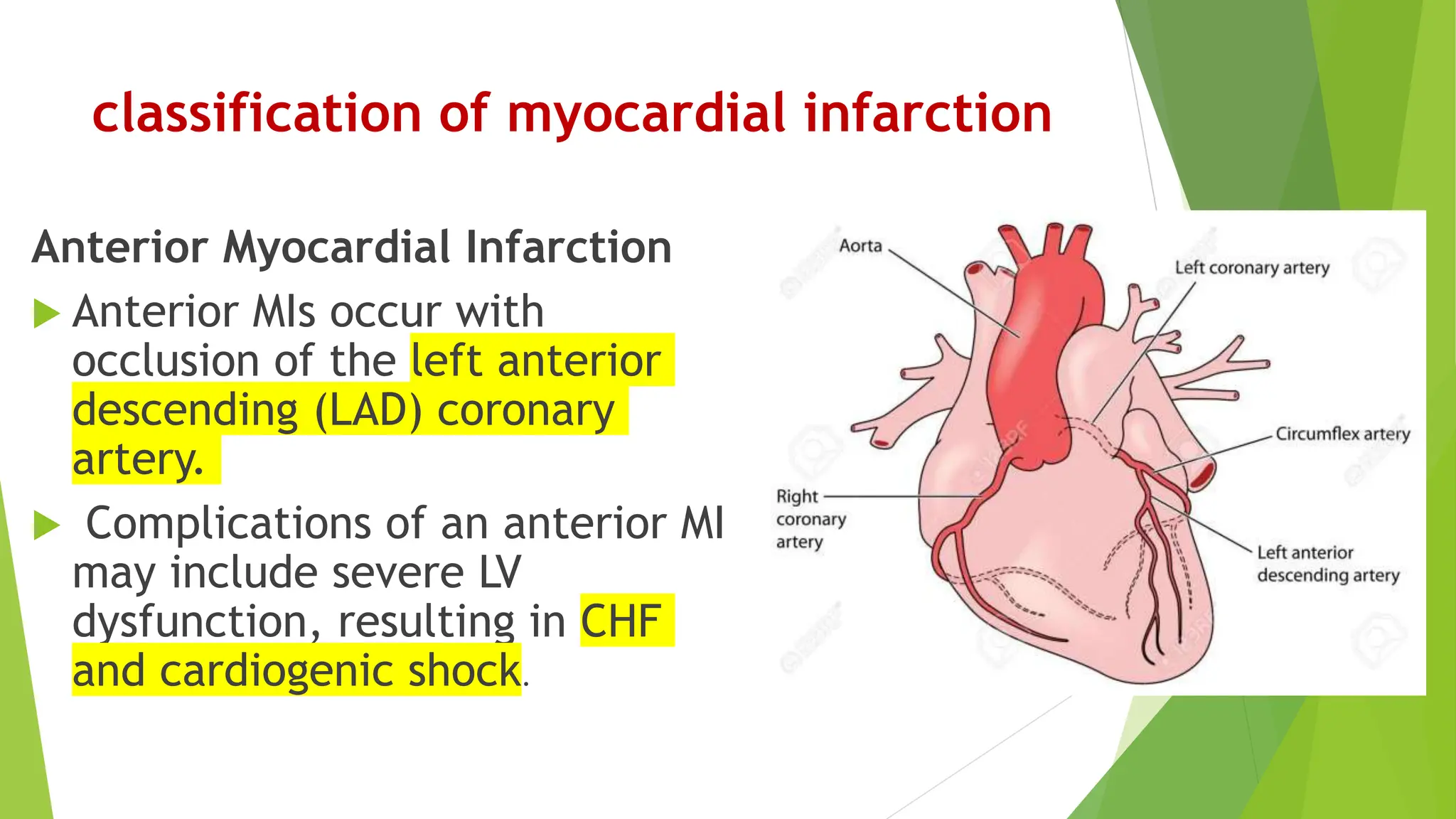 MYOCARDIAL INFARCTION nursing management | PPTX