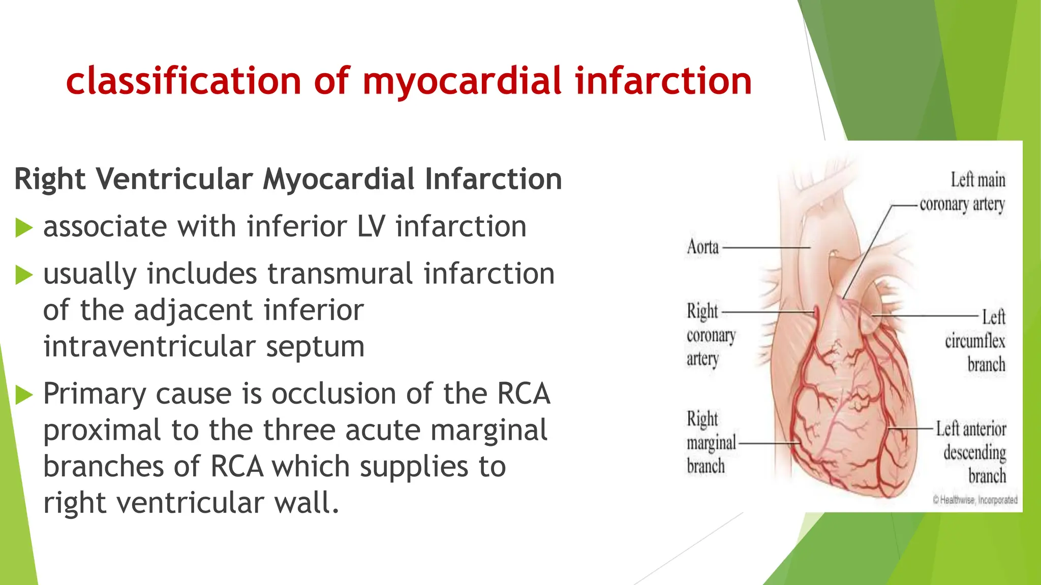 MYOCARDIAL INFARCTION nursing management | PPTX