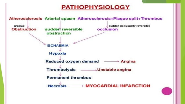 MYOCARDIAL INFARCTION nursing management | PPTX | Heart and ...