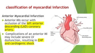 MYOCARDIAL INFARCTION nursing management | PPTX