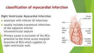 MYOCARDIAL INFARCTION nursing management | PPTX