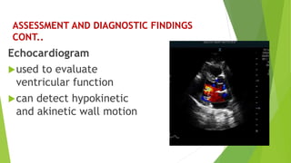 MYOCARDIAL INFARCTION nursing management | PPTX