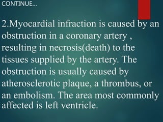 MYOCARDIAL INFRACTION.pptx
