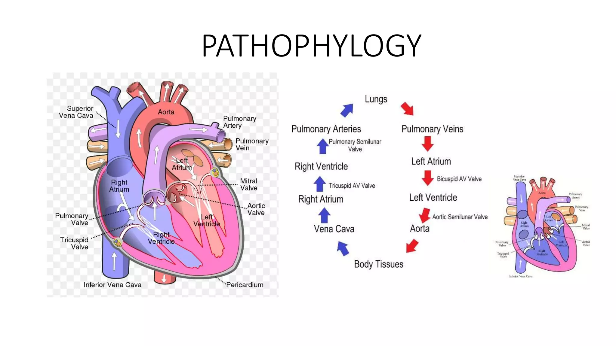 MYOCARDIAL INFRACTION CASE REPORT.pptx
