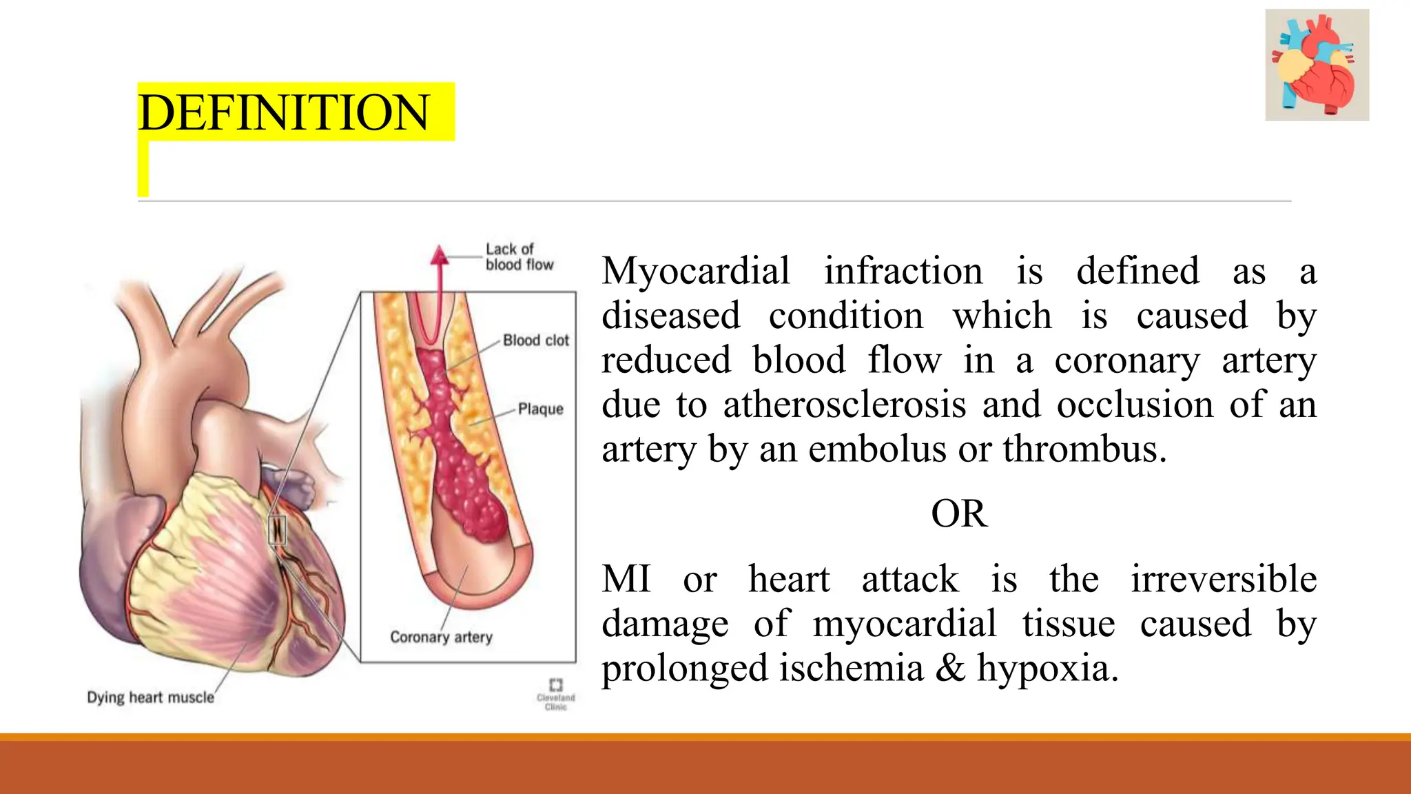Nursing management of cardiovascular disorder. Myocardial infraction | PPTX