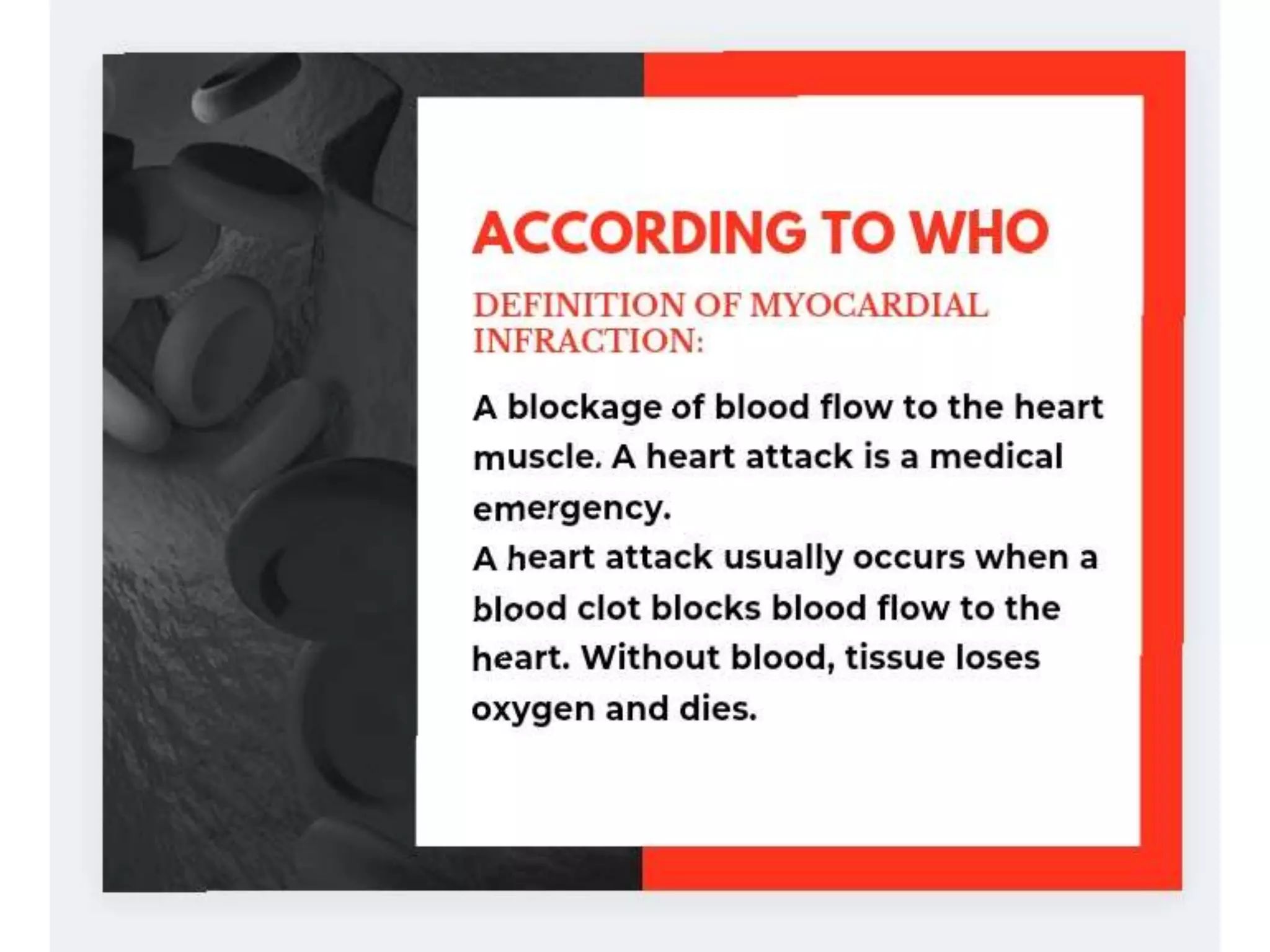 Myocardial infraction pathophysiology | PPTX