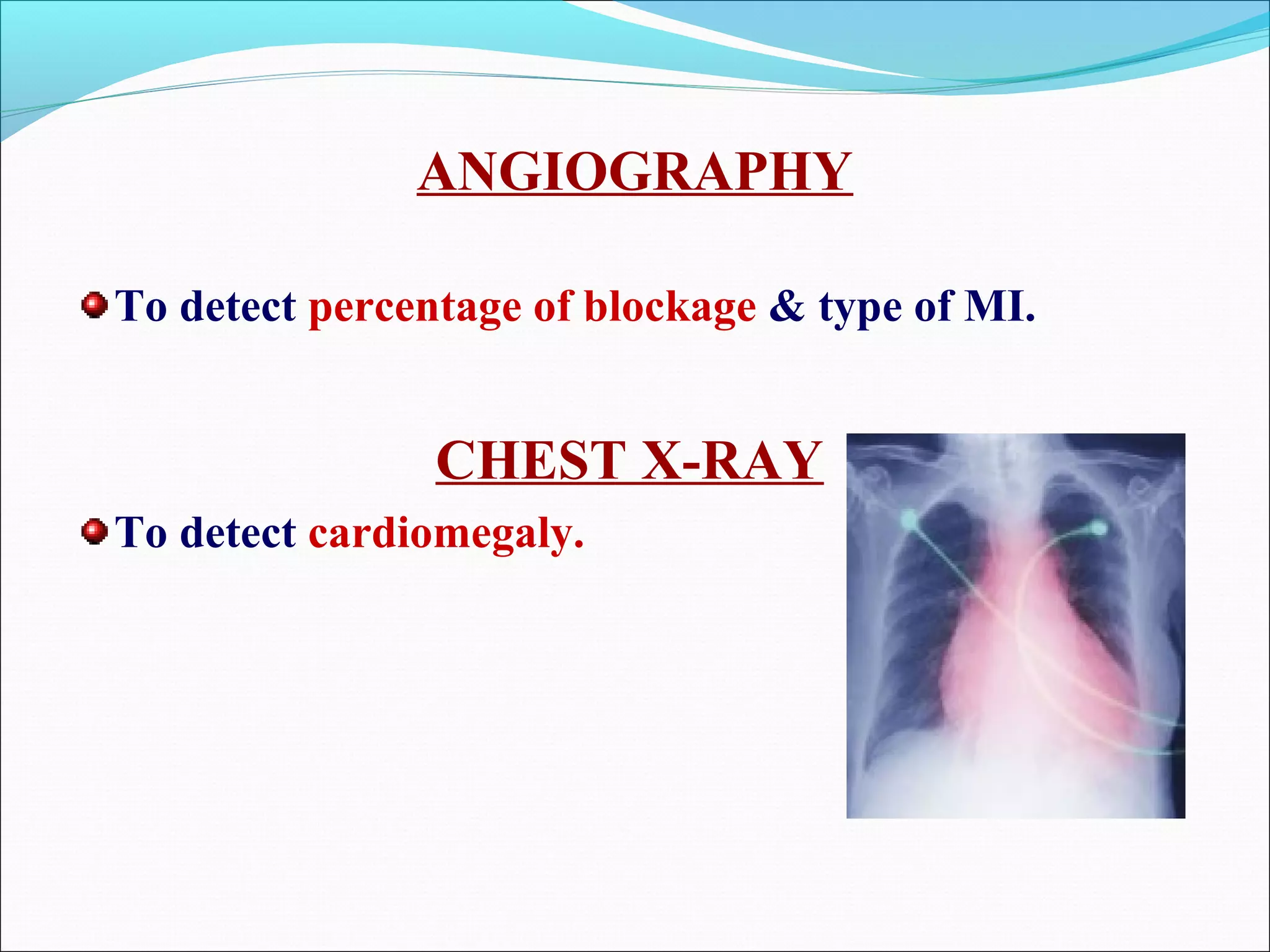Myocardial infarction | PPT