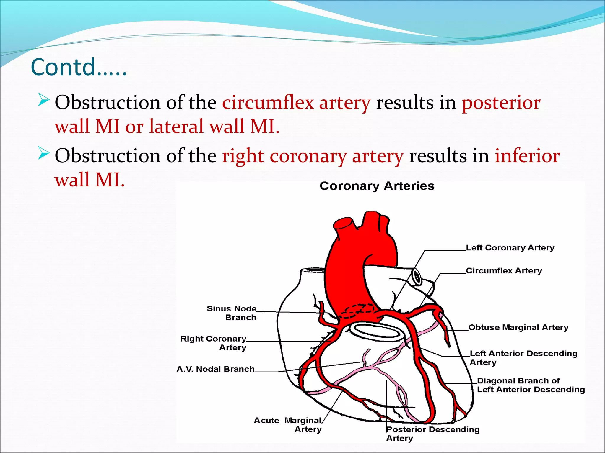 Myocardial infarction | PPT