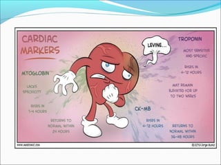 Myocardial Infarction Animation