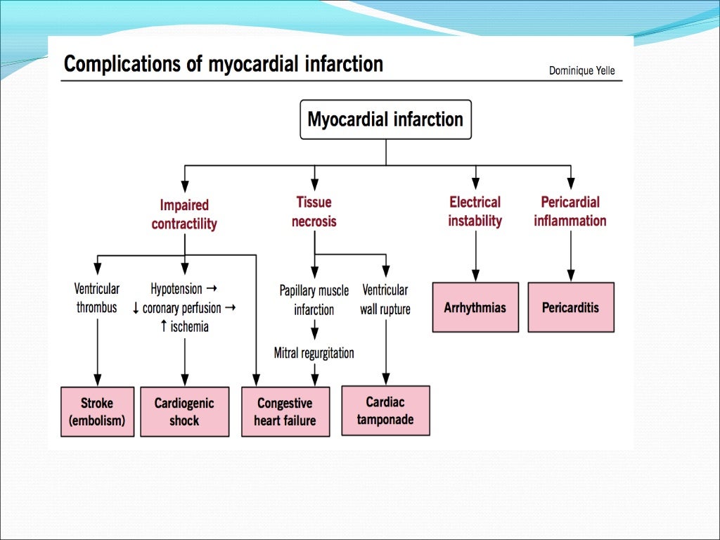 Myocardial infarction