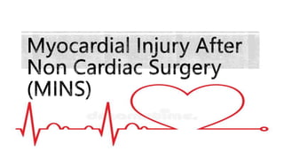 Myocardial injury after non cardiac surgery (MINS.pptx