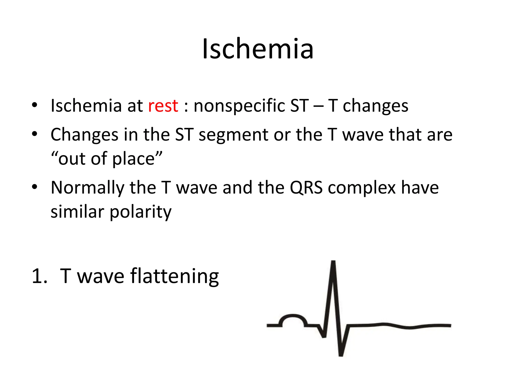 acute coronary syndrome (infarction and ischemia) | PPT | Heart and ...