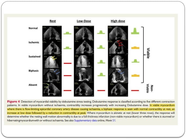 myocardial viability in severe lv dysfunction | PPT