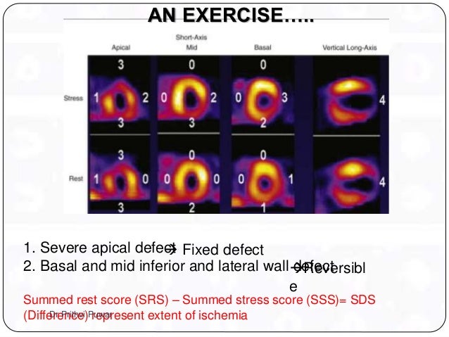 Myocardial viability