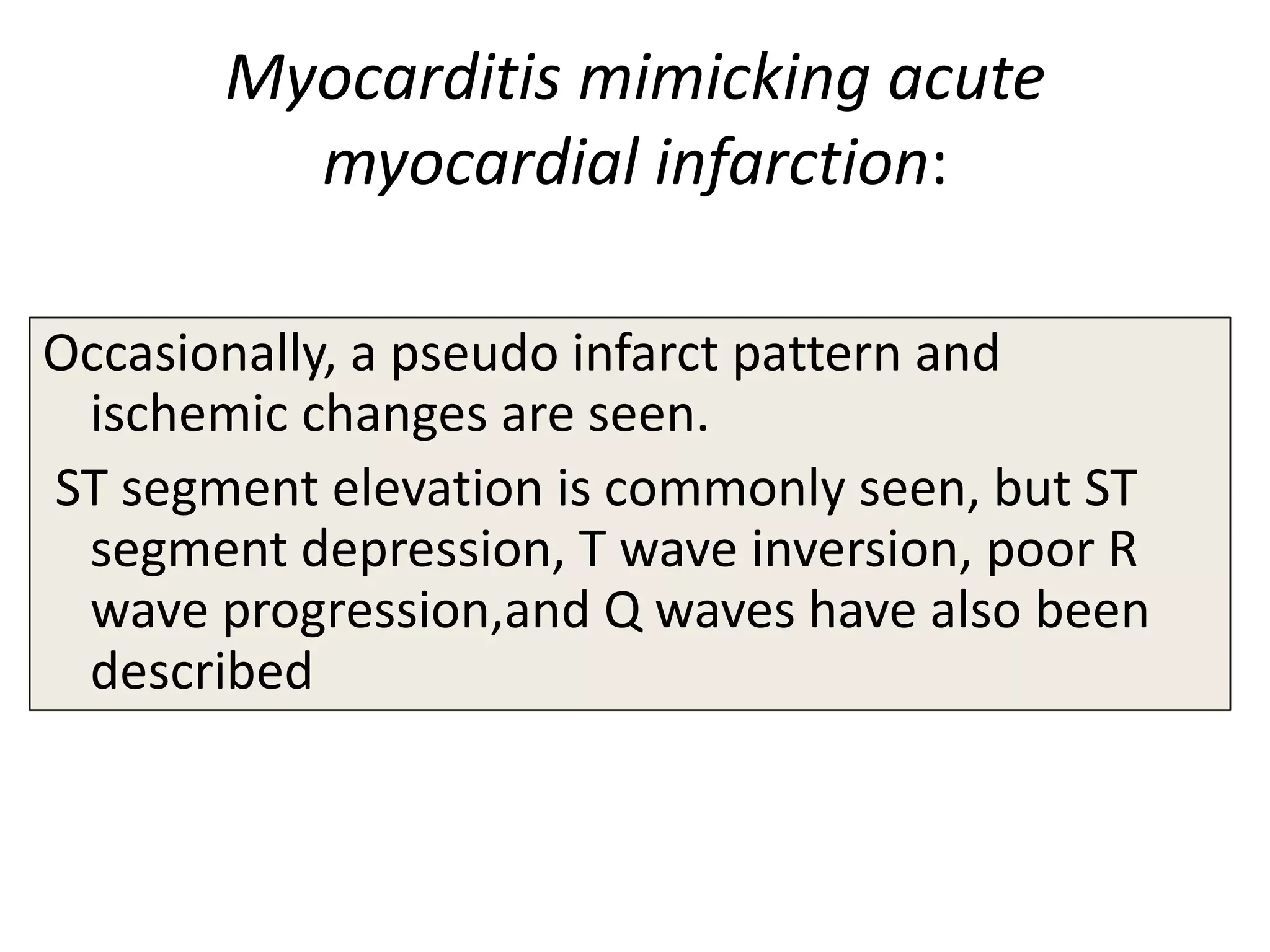 Myocarditis | PPTX