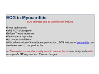 Myocarditis Ecg Changes