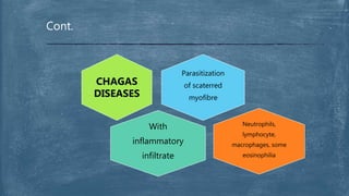 Myocarditis | PPTX