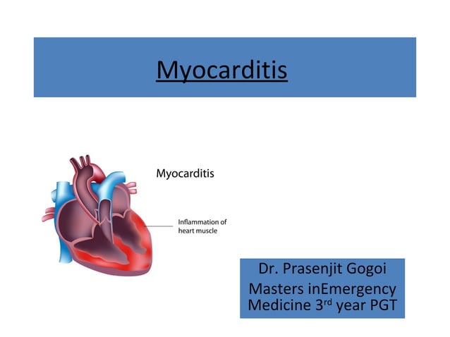 Myocarditis | PPT
