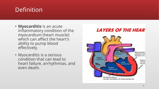 Cardiology weekly session on Myocarditis-2.pptx